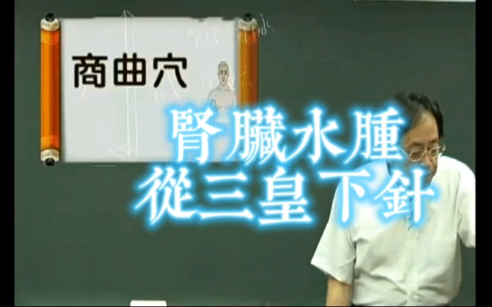 肾脏下半身水肿可从三皇穴下针治疗