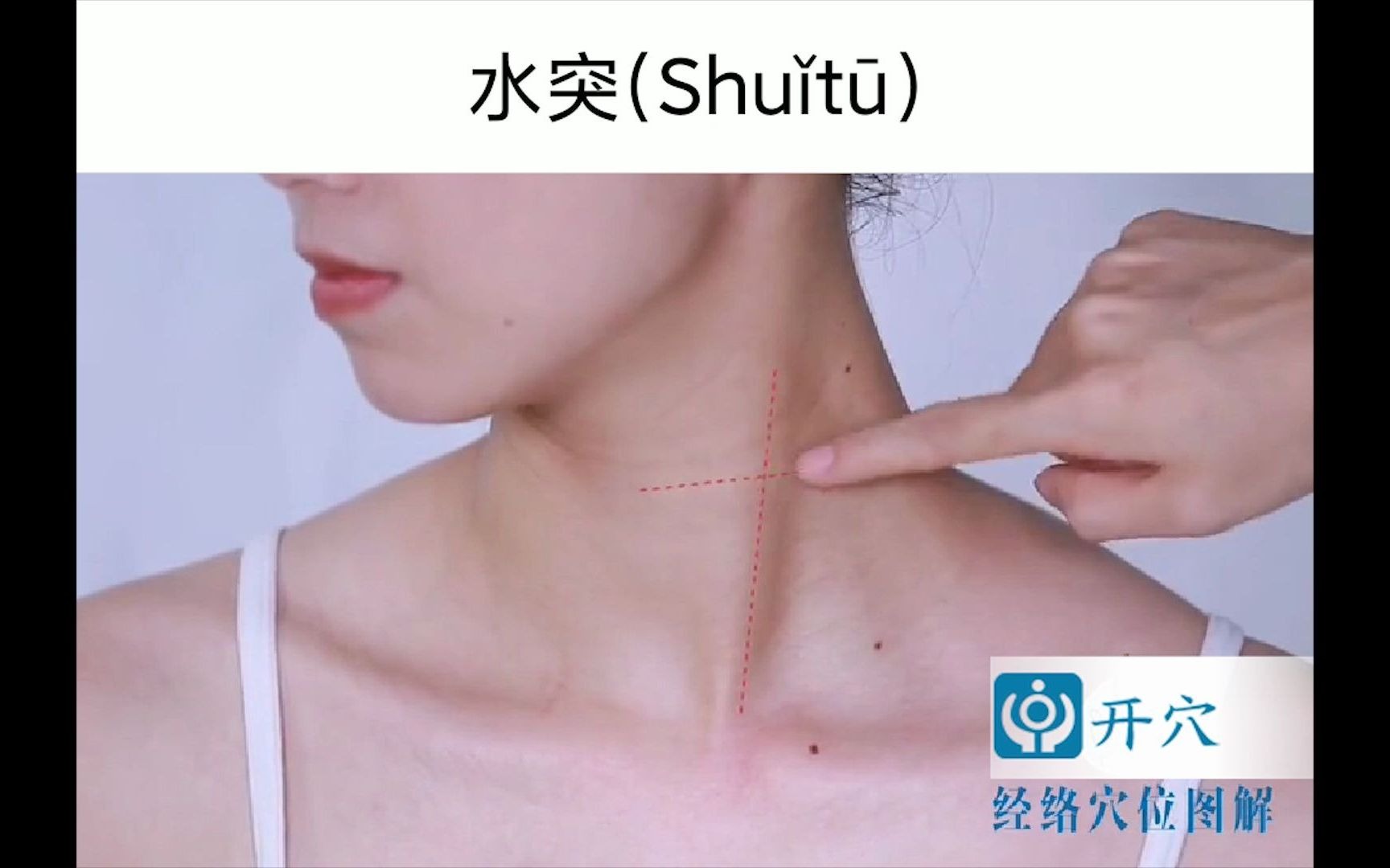 ...视频:水突(定位:在颈部,胸锁乳突肌的前缘,当人迎与气舍连线的中点。)