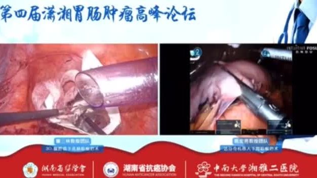 戴维医疗电动腔镜吻合器在“第四届潇湘胃肠肿瘤高峰论坛