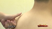 肩井穴-中医治疗肩周疾病之法—刺激肩井穴