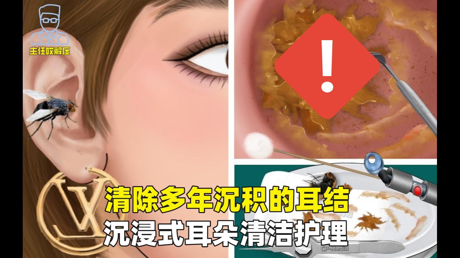 解压动画,清除多年沉积的耳结,沉浸式耳朵清洁护理