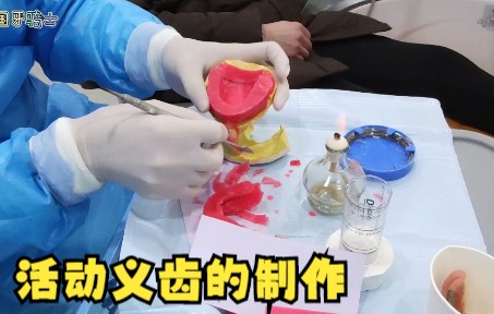 牙医现场制作活动义齿,都是技术活