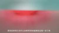 受伤后的伤口为什么会痒?用3D动画模拟,过程一目了然!