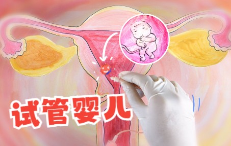 你知道试管婴儿是怎么做的吗?