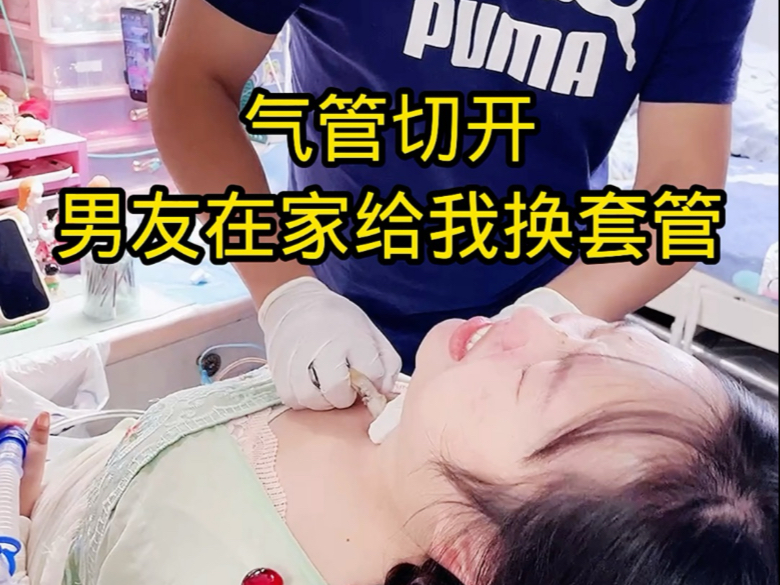 ...只能缓解,逼不得已了 最后只能试试我最害怕的,(更换脖子里面的套管)