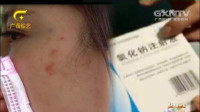 女子到美容医院保养,岂料“水光针”变“氯化钠”,惨遭毁容