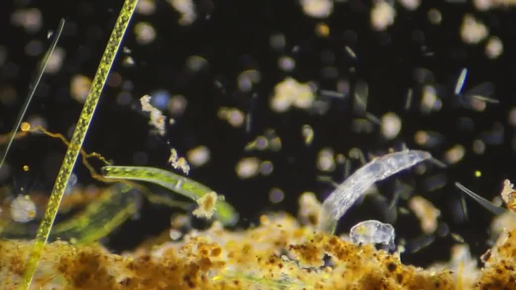 高倍显微镜下精彩的世界,微生物们正在吃饭