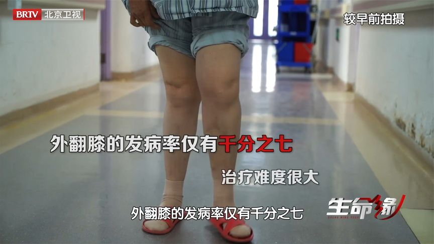 1分钟重建骨骼?3D影像重建和3D打印技术应用在医学领域有多厉害