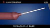 HD狼和牌包皮环切缝合器演示动画