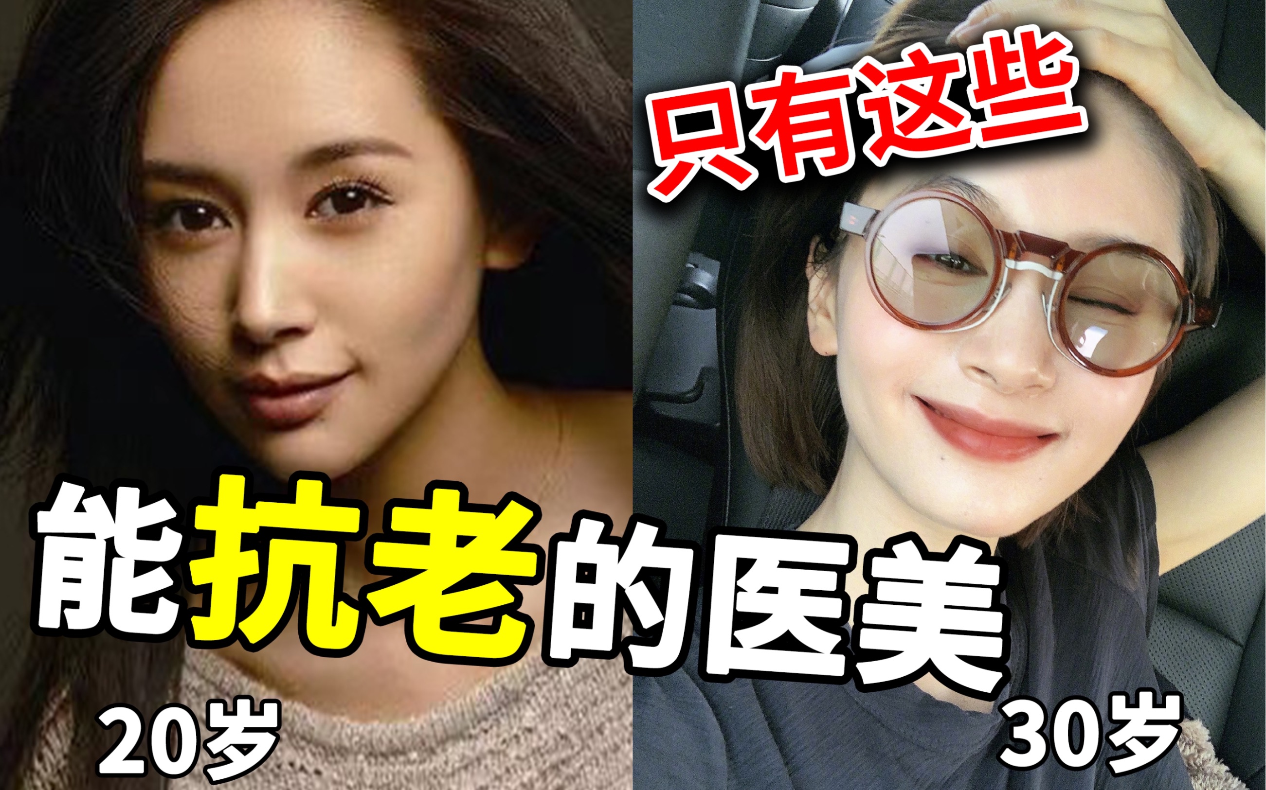 盘点入门级医美项目,初抗老怎么选?法令纹坚决不能做这项!