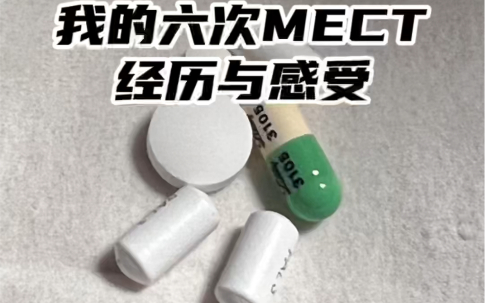 【抑郁症/双相】做了六次MECT电休克的感受及治疗流程分享