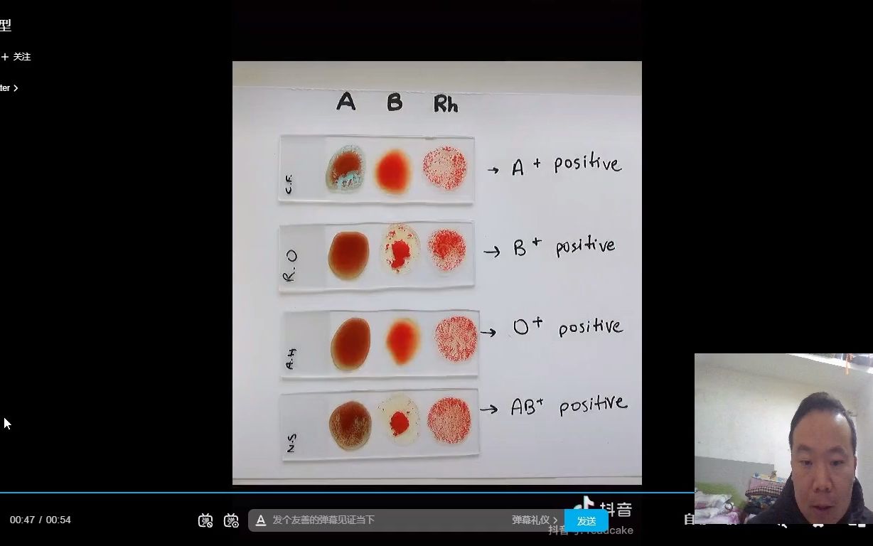 实验:ABO血型鉴定