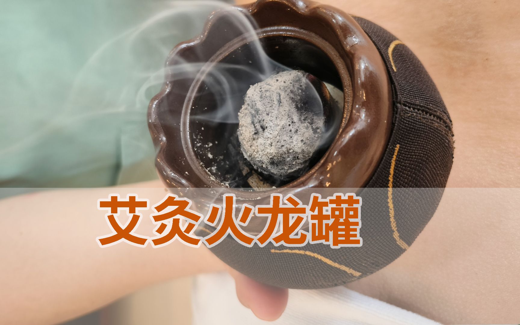 中医特色技术|艾灸火龙罐,疏经通络,排寒排湿,但它为什么不掉灰呢?
