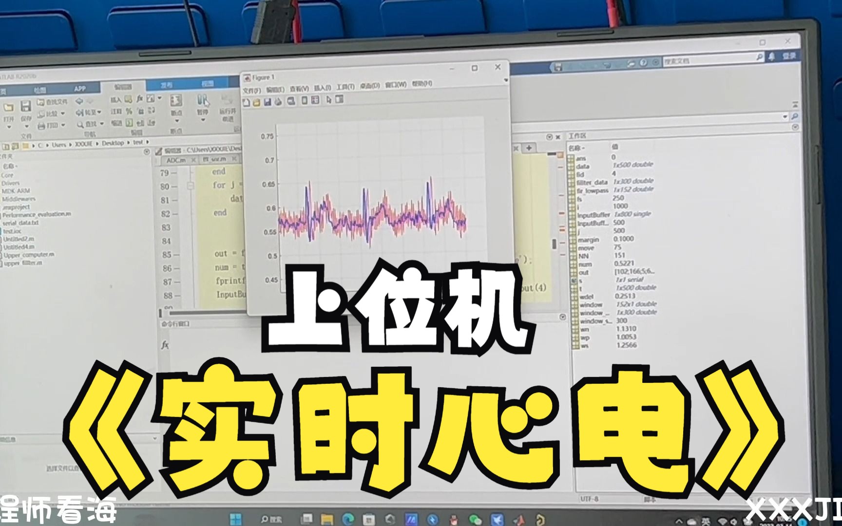 7-同学投稿,STM32采集心电信号发送到上位机实时显示