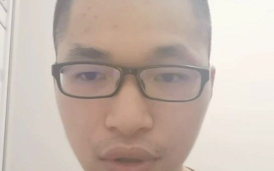 单子叶植物和双子叶植物种子幼苗生长观察实验