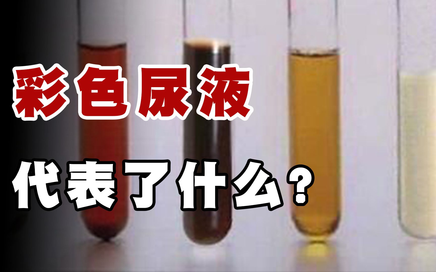 水喝多尿液是无色的,不同颜色会反映不同状况,你的身体怎么样?