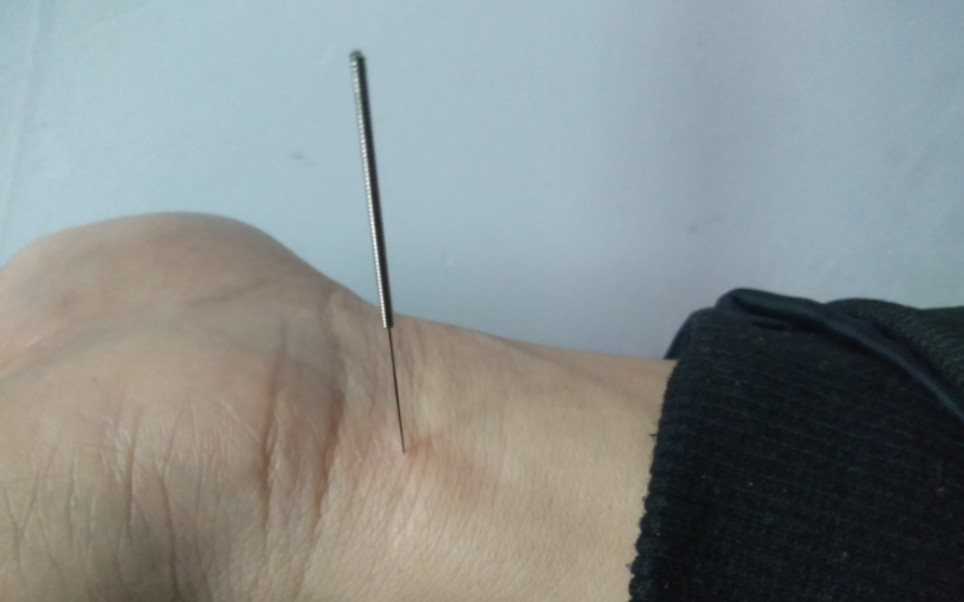 针灸每日一练~神门穴