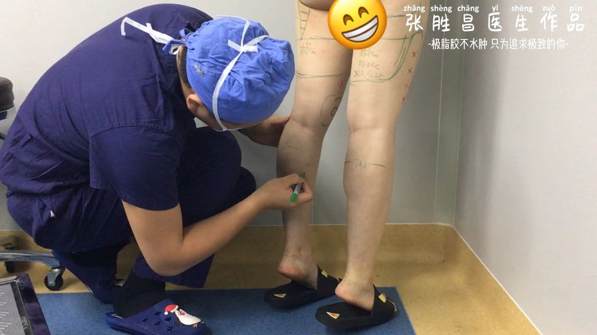 打肉毒素瘦小腿有作用?