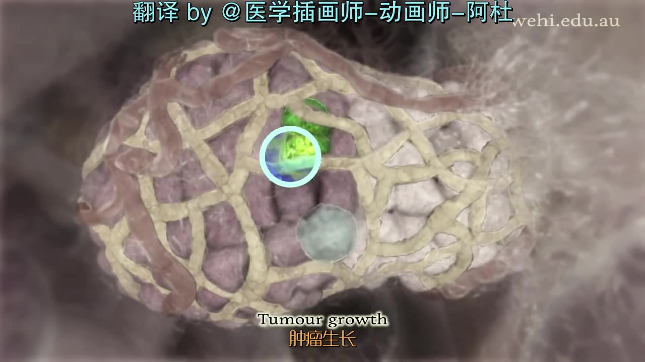 【中英文双语字幕版】【3D医学动画】乳腺癌的起源