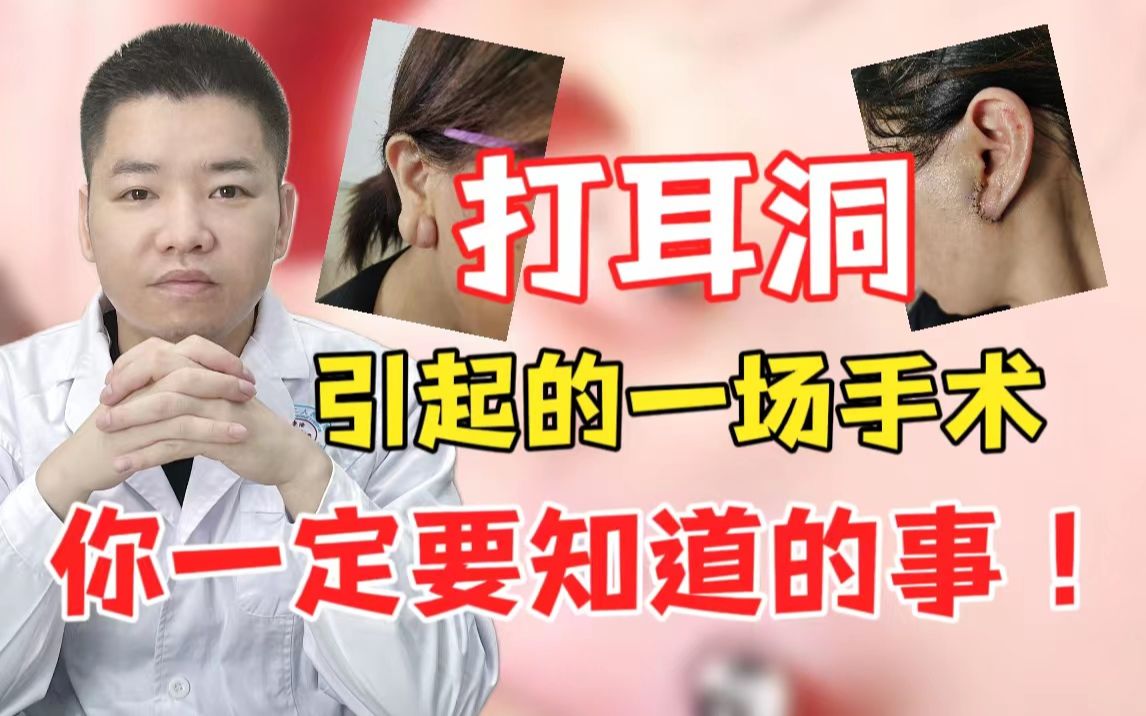 打耳洞造成的瘢痕疙瘩案例,术后真实照片!慎入!