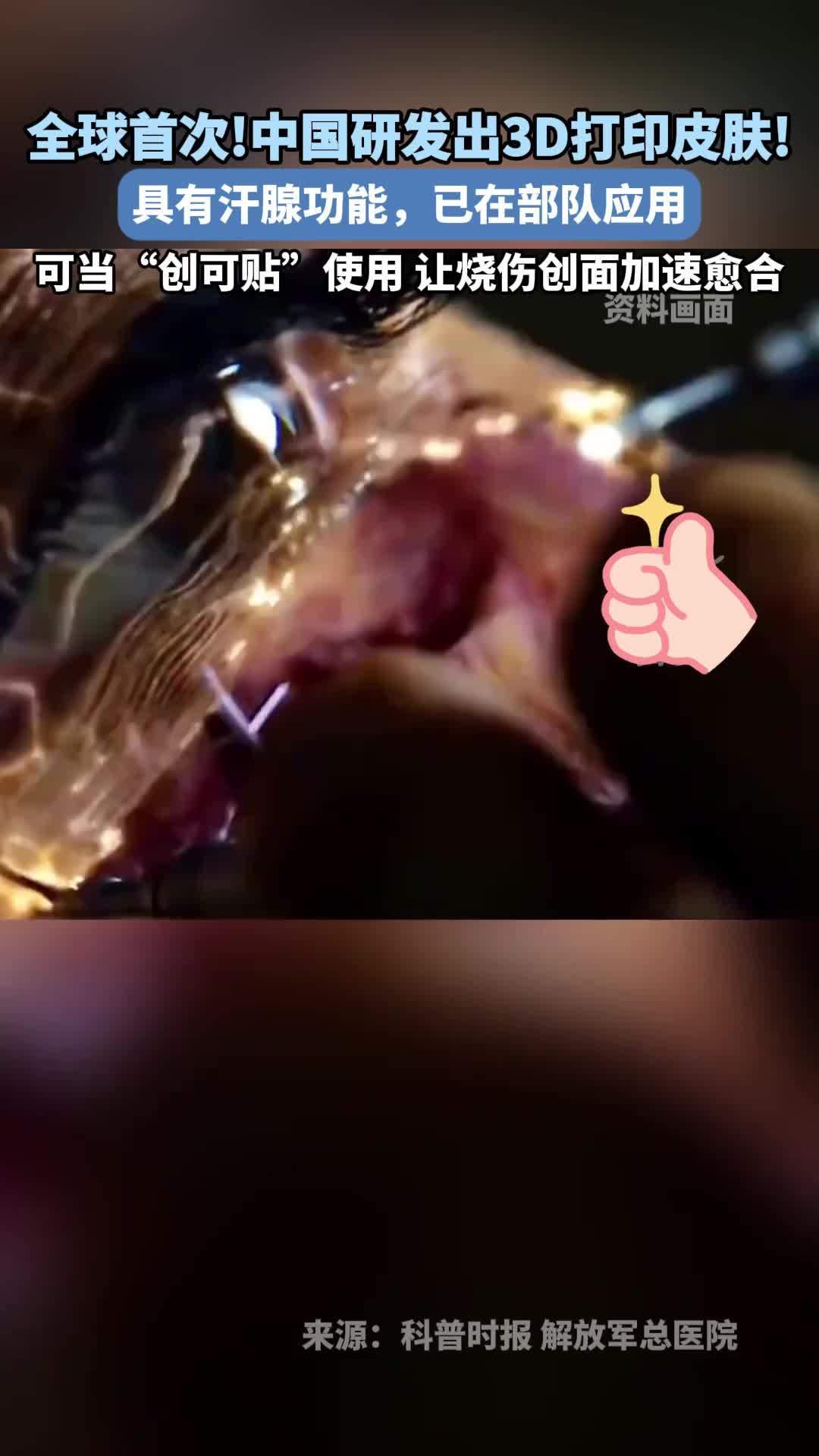全球首次!中国研发出3D打印皮肤!具有汗腺功能,已在部队应用