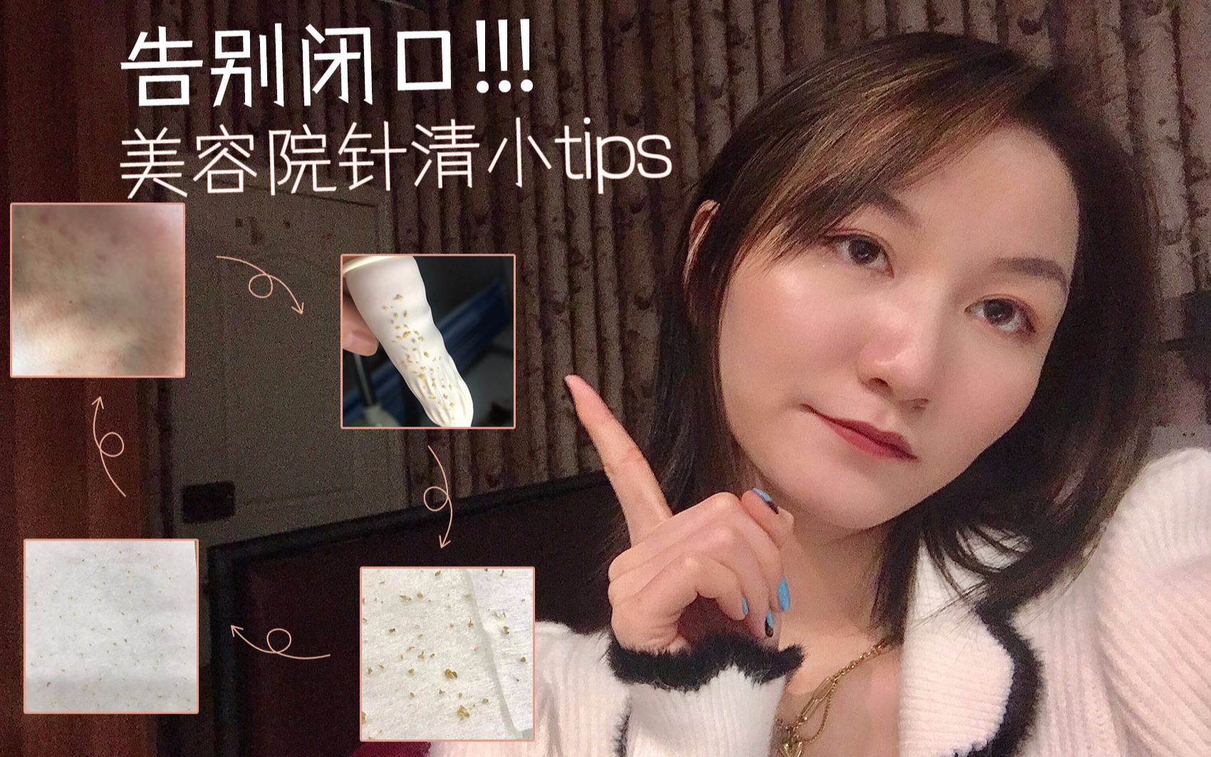 告别闭口,去美容院针清需要注意的一些小tips