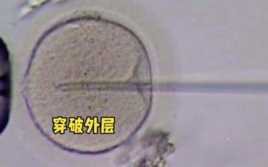 试管婴儿宝宝的受精过程大揭秘:生命的诞生过程,清晰可见!
