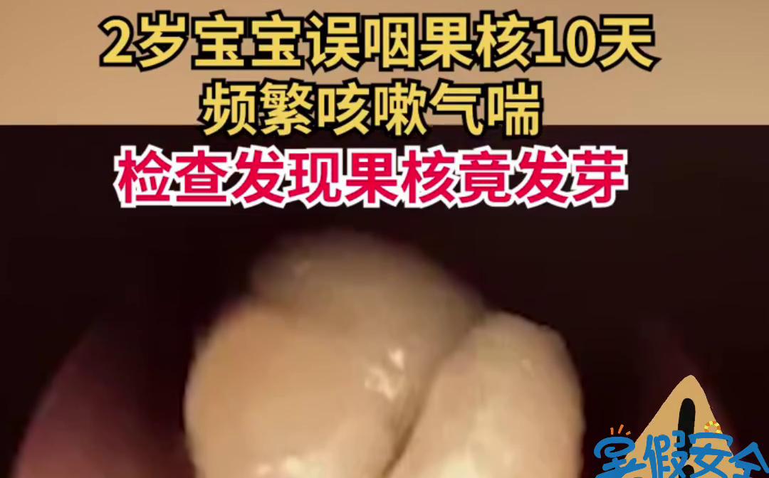 气管里进了种子真的会发芽,小时候担心的事情原来真的会发生【2岁...