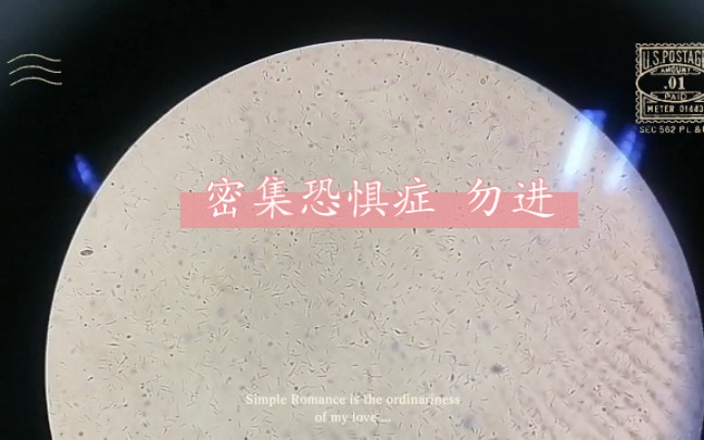 光学显微镜下 细菌的运动观察(密集恐惧症 勿进)