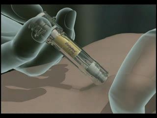 戈舍瑞林安全针注射演示