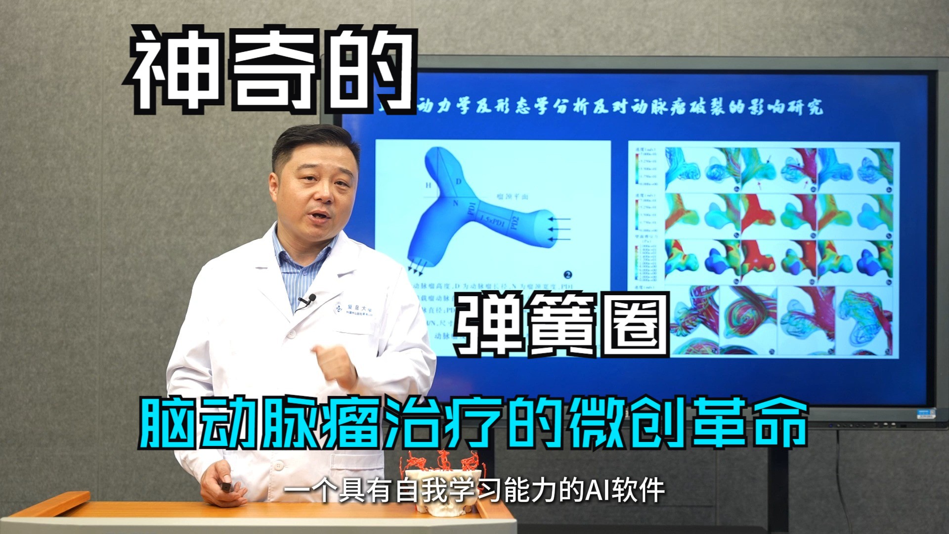 神奇的弹簧圈:脑动脉瘤治疗的微创革命