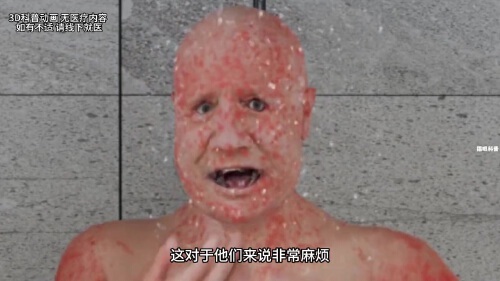 你们知道皮肤对水的话会发生什么吗?看完你就明白了动画