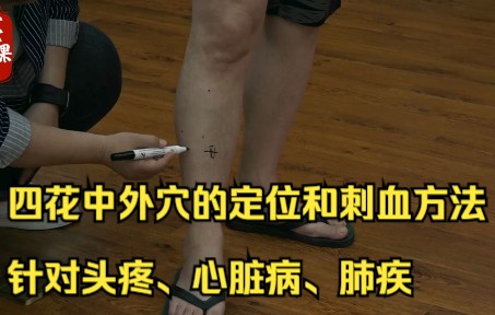 刘红云讲四花中外穴的定位和刺血方法,针对头疼、心脏病、肺疾