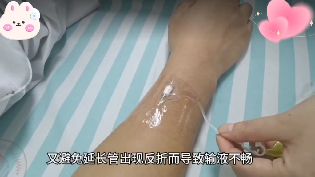 滞留针固定方法,实习护士码住!