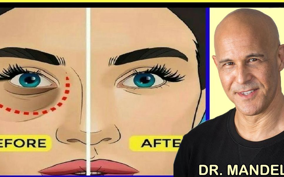 熬夜者福音!尝试这些科学自然的方法消除黑眼圈【Mandell博士】