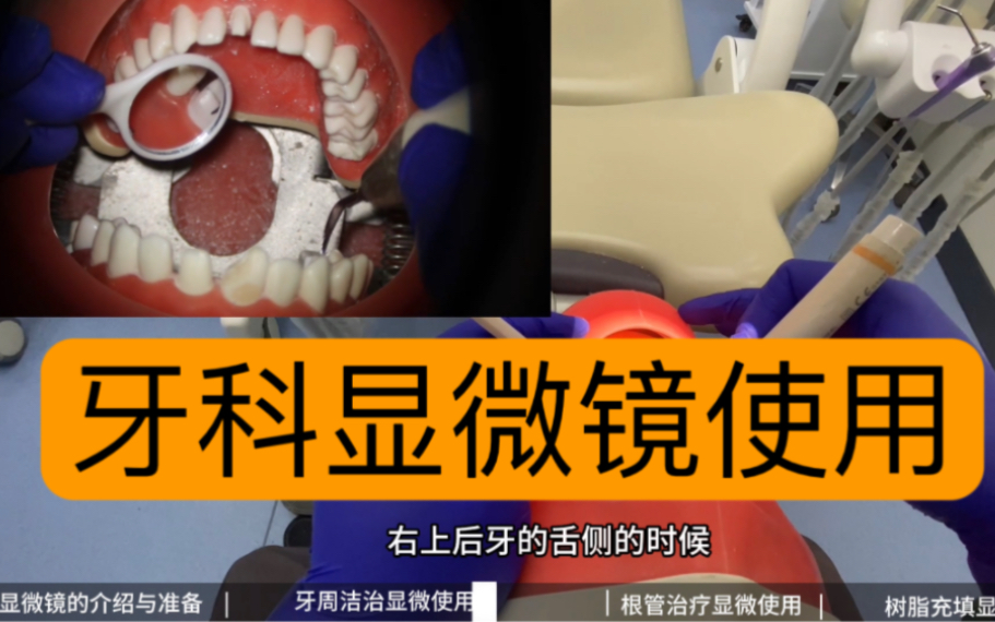 在临床不同情况下,我是如何使用口腔显微镜的
