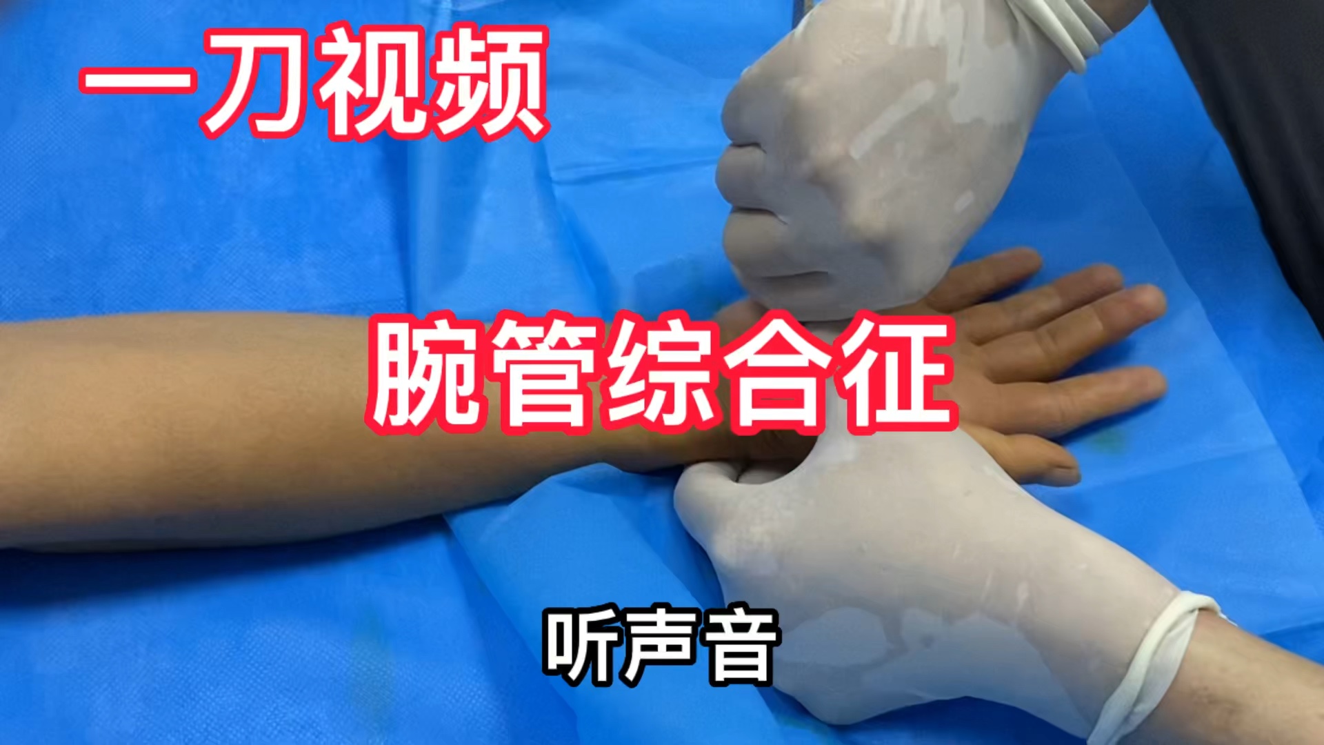 一刀开鞘术秒杀腕管综合征手麻