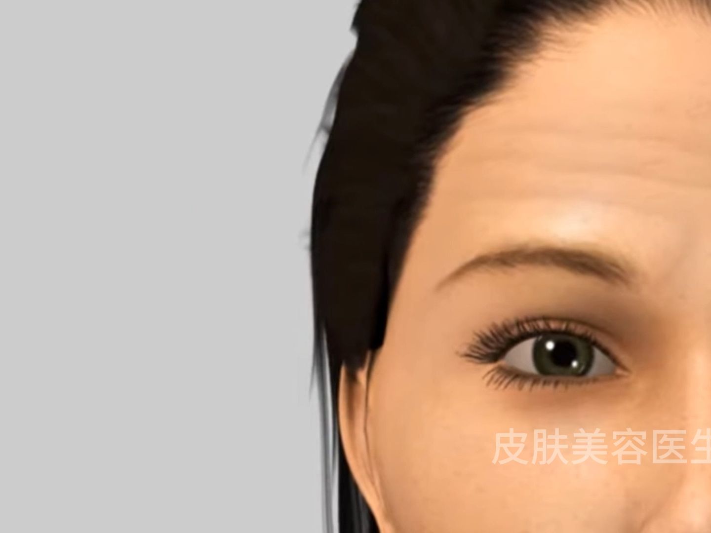 3D演示演示肉毒素注射过程