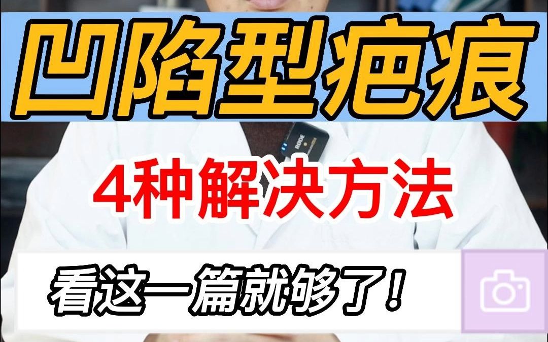 凹陷型疤痕治疗方法分享!纯干货,时常3分半,码住先看