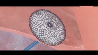 3D动画演示先心及动脉导管未闭