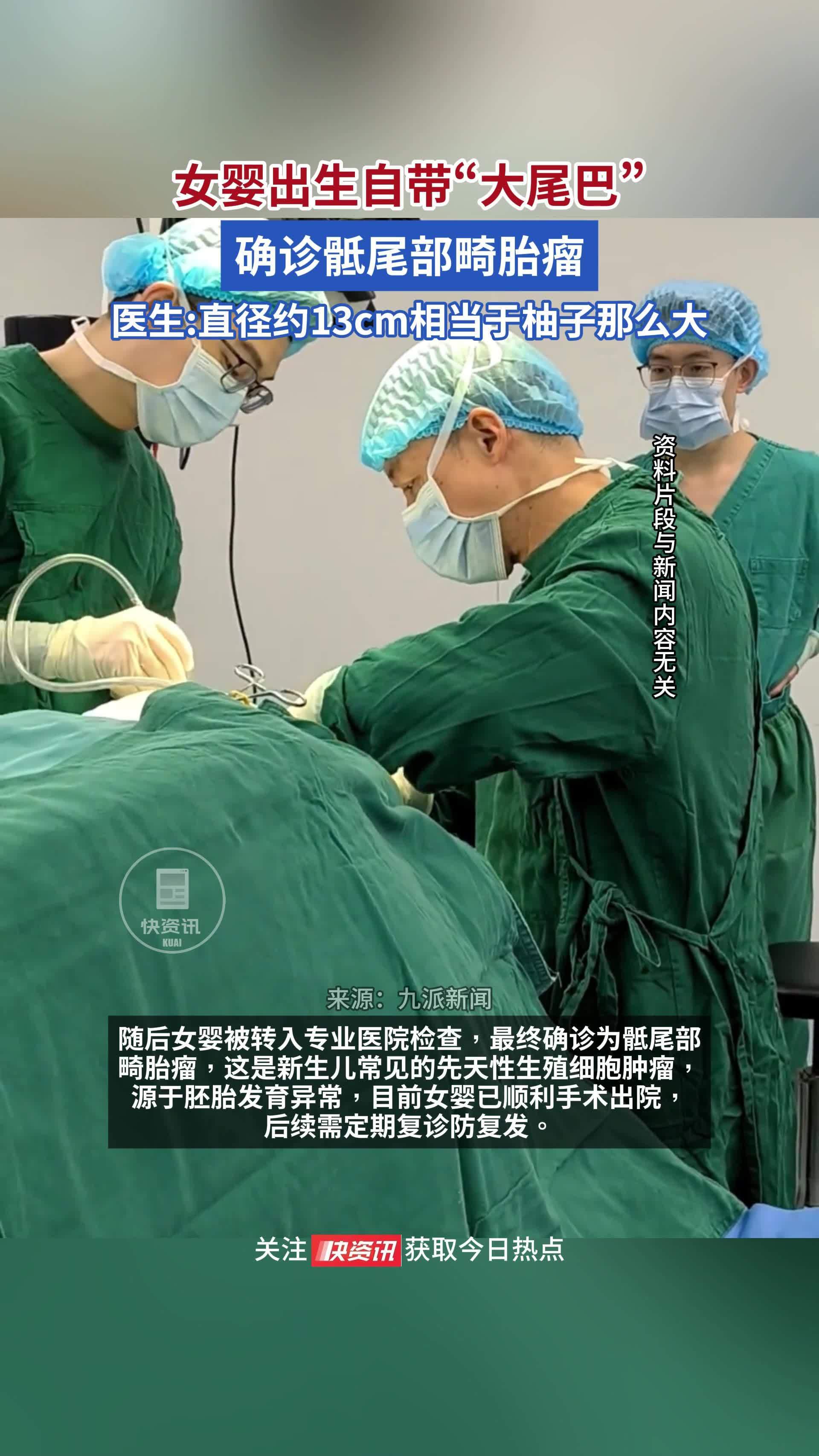 女婴出生自带"大尾巴" 确诊骶尾部畸胎瘤