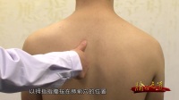 肺俞穴-调补肺气之法