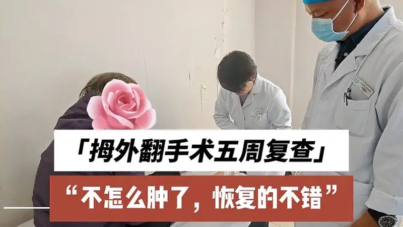 拇外翻手术五周来复查了,不怎么肿了,恢复的不错