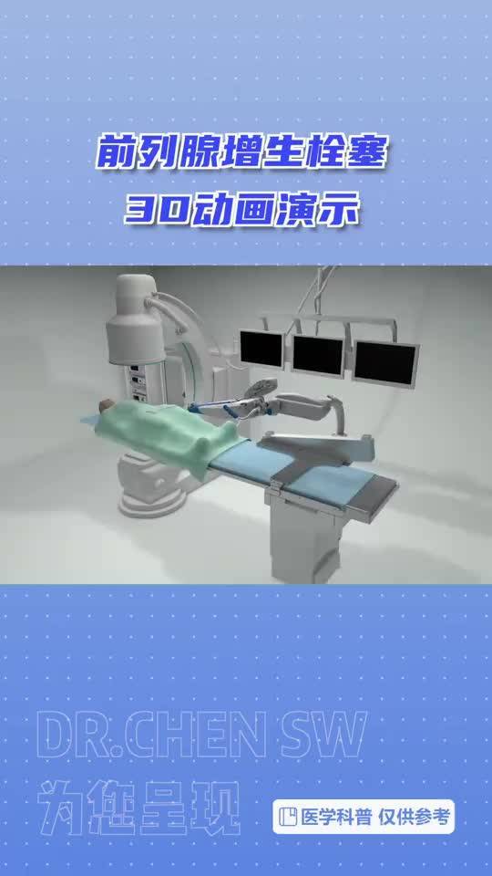 前列腺增生栓塞3D动画演示