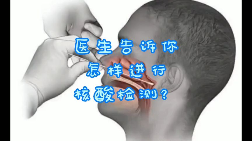 医生告诉你,怎么核酸检测?
