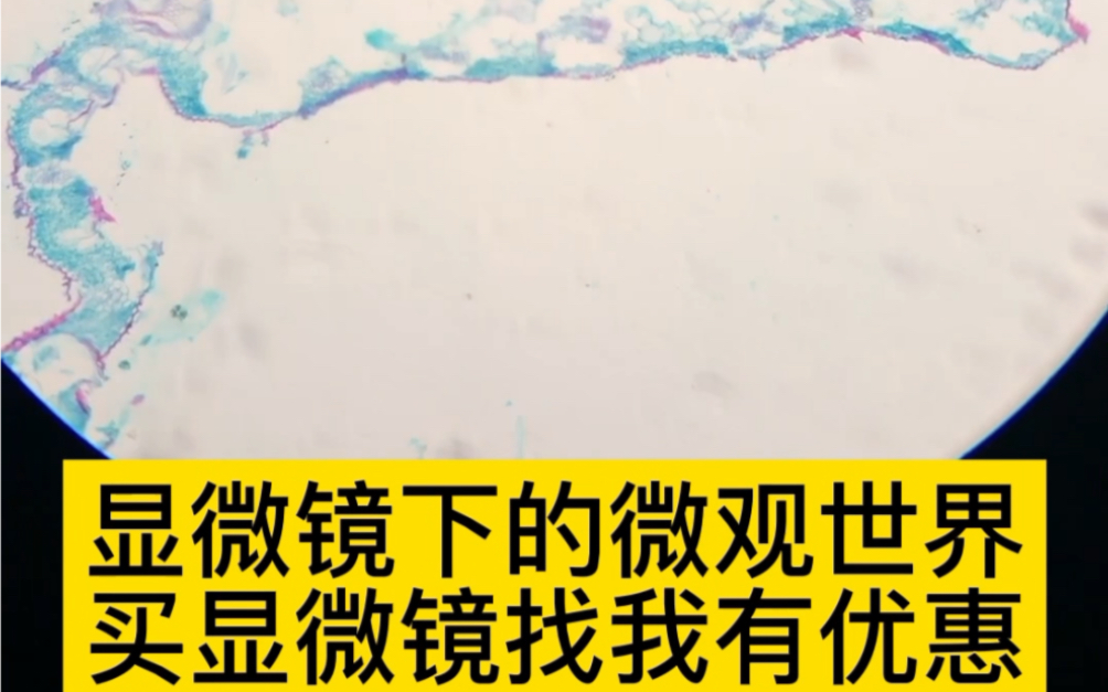 凤凰显微镜下的微观世界