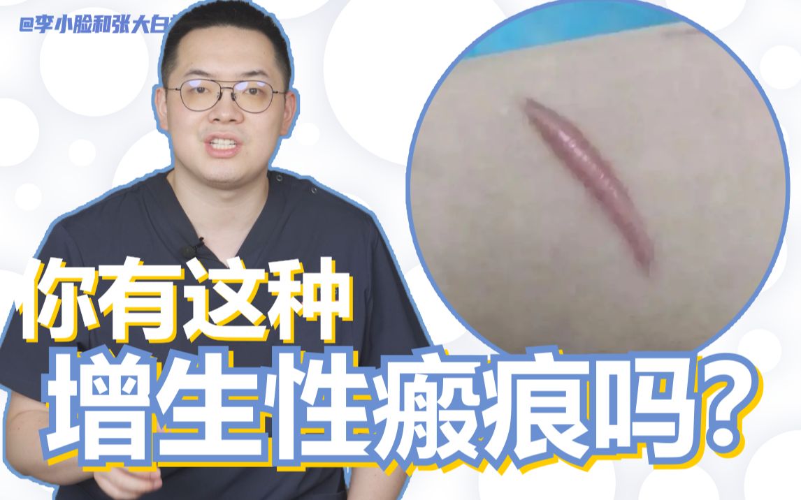 【效果超棒!】点阵激光治疗增生性瘢痕!