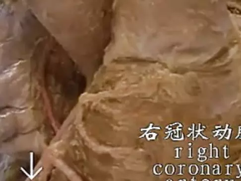 心血管系统解剖