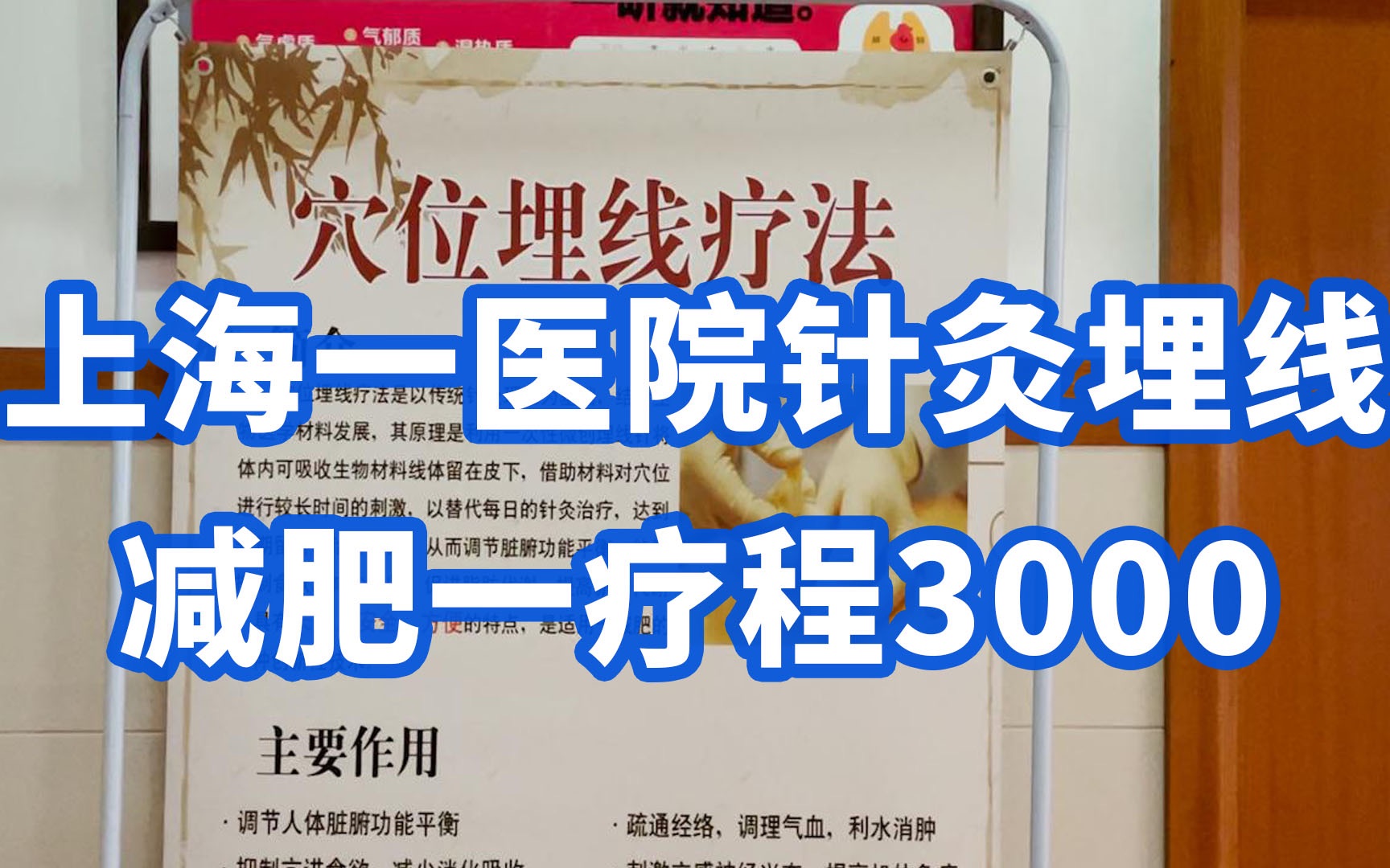减肥新思路!上海一医院针灸埋线减肥一疗程3000:可抑制亢进的食欲,并...