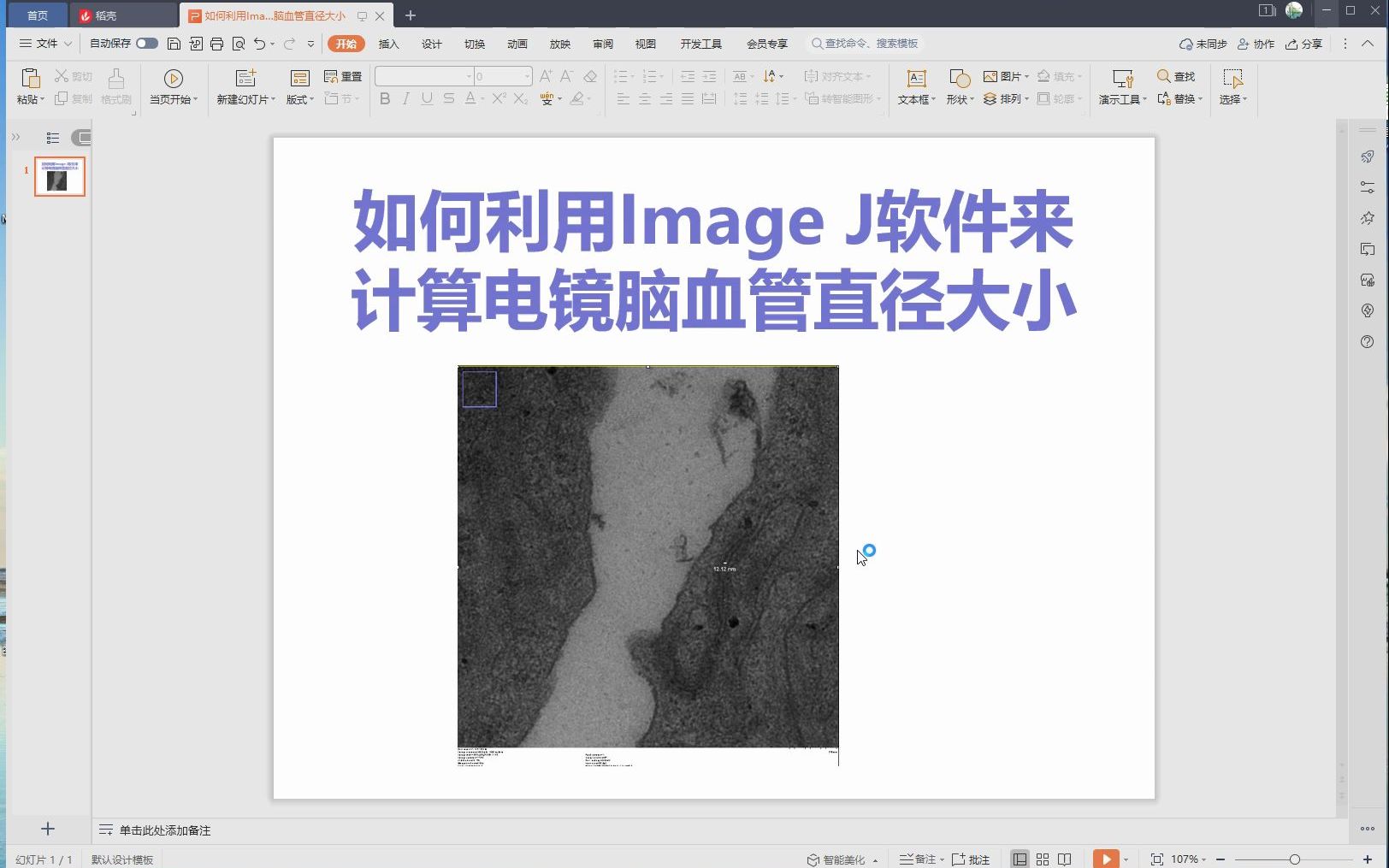 如何利用Image J软件来计算电镜脑血管直径大小